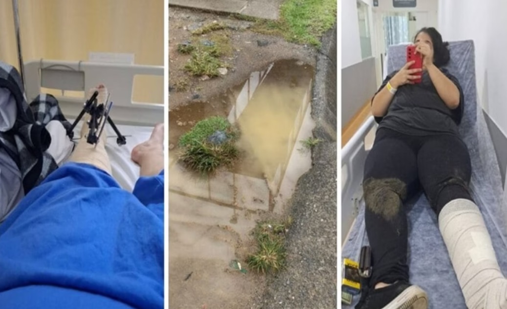 Professora cai em buraco após descer do ônibus e passa por três cirurgias